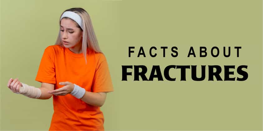 Facts About Fractures – A Guide to Broken Bones