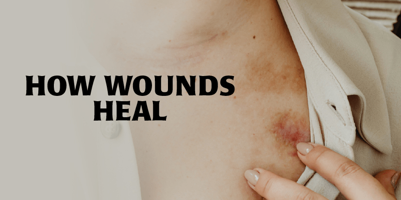 How Wounds Heal—and What Happens When the Body Needs Help